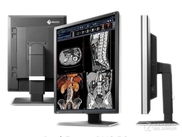 【Eizo RadiForce RX250】报价_参数_图片_论坛_Eizo Eizo RX250,RadiForce RX250艺卓医疗显示 ...